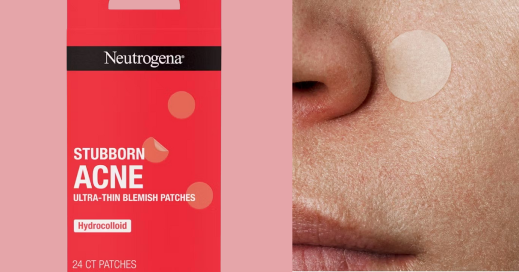 Possible Free Nuetrogena Stubborn Acne Blemish Patches Samples - The ...